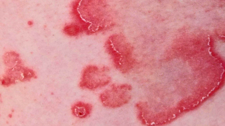 Dr Tai Phan - Consultant Dermatologist and Mohs Surgeon - Providing ...